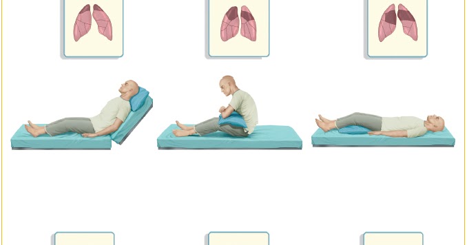 Los mejores años de nuestra vida: NECESIDAD DE RESPIRAR : Asma y fisioterapia respiratoria