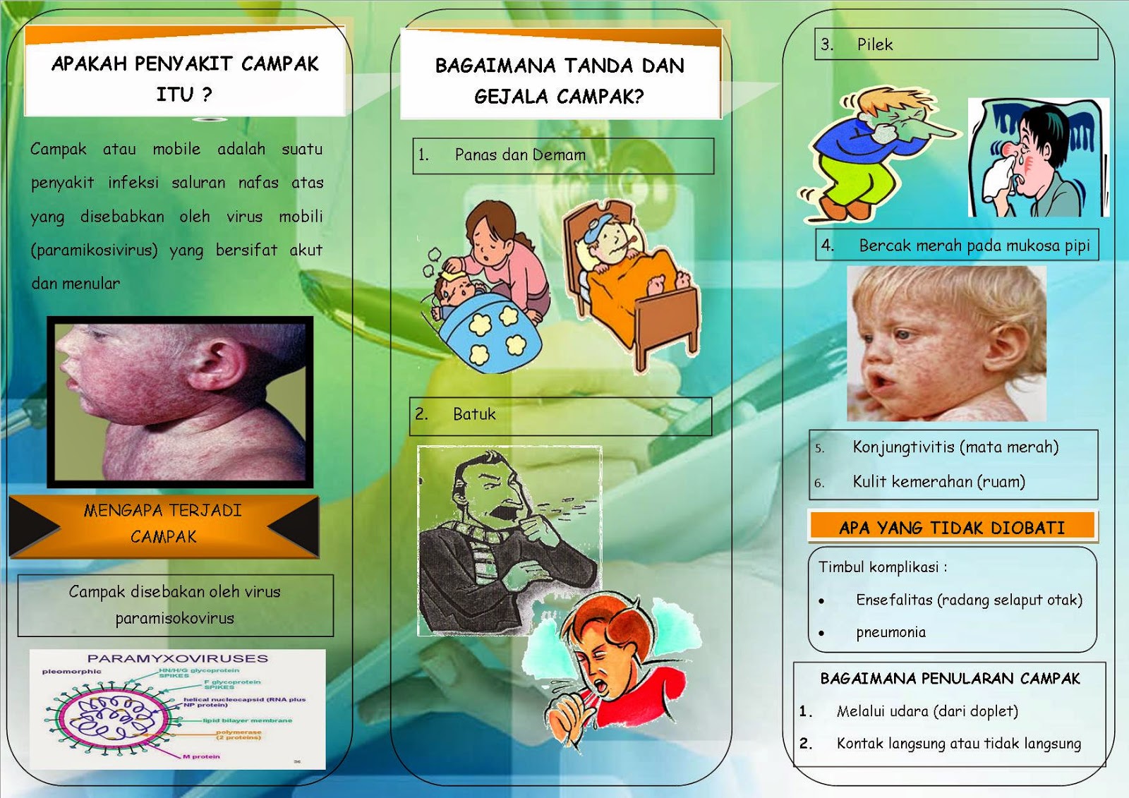 Leaflet Campak ~ seputar keperawatan