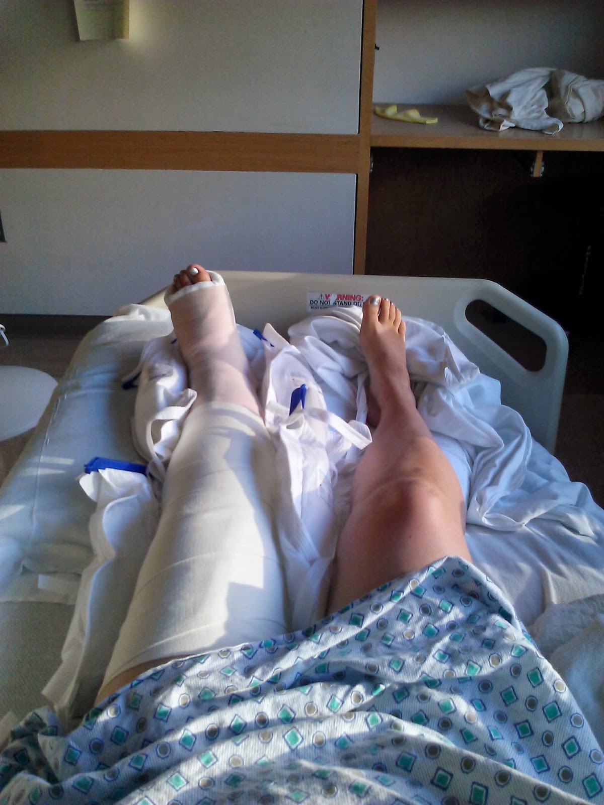 My Retro Kitchen Break A Leg Literally my-retro-kitchen-break-a-leg-literally