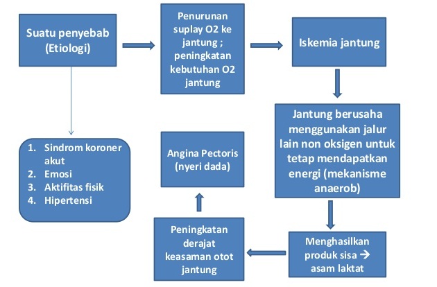 Angina Pektoris ~ Informasi Kedokteran Dan Kesehatan