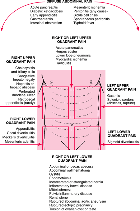 medicalsham: Differential Diagnosis of Abdominal Pain medicalsham: Differential Diagnosis of Abdominal Pain