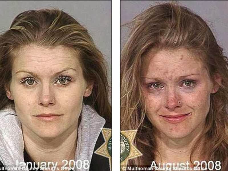 De Drogas Ilegales: Efectos visibles de las drogas en el rostro