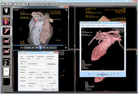 Radiant Dicom Viewer Crack REPACKed 75