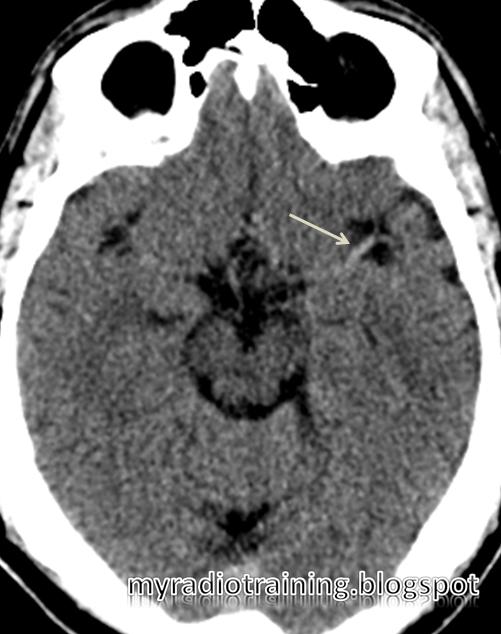 Radiology info hub: CNS