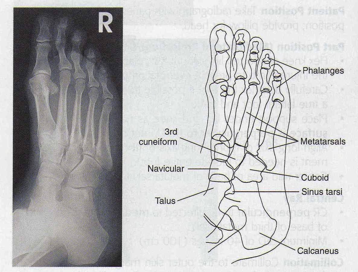 Teknik Radiografi Ossa Pedis ~ RADIOLOGI
