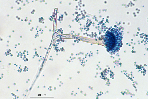 Microscopic morphology of Aspergillus | Geoffrey E. Reed life