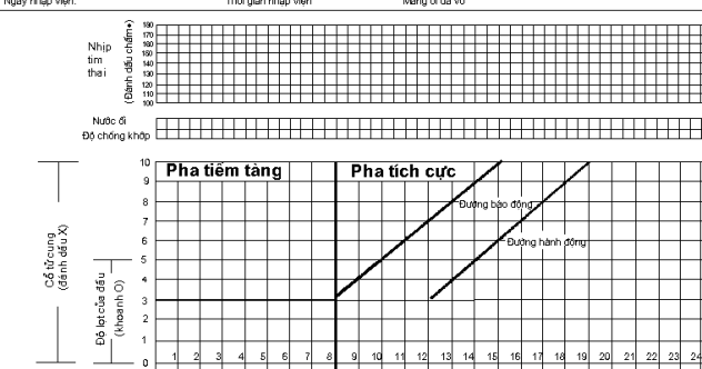 Biểu đồ chuyển dạ | Bác Sĩ Đa Khoa