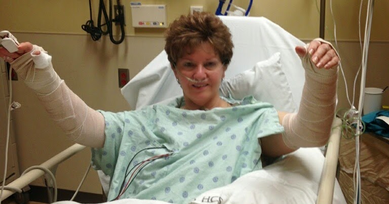 Joan's Broken Arms Blog: Double broken arms=double surgery:(