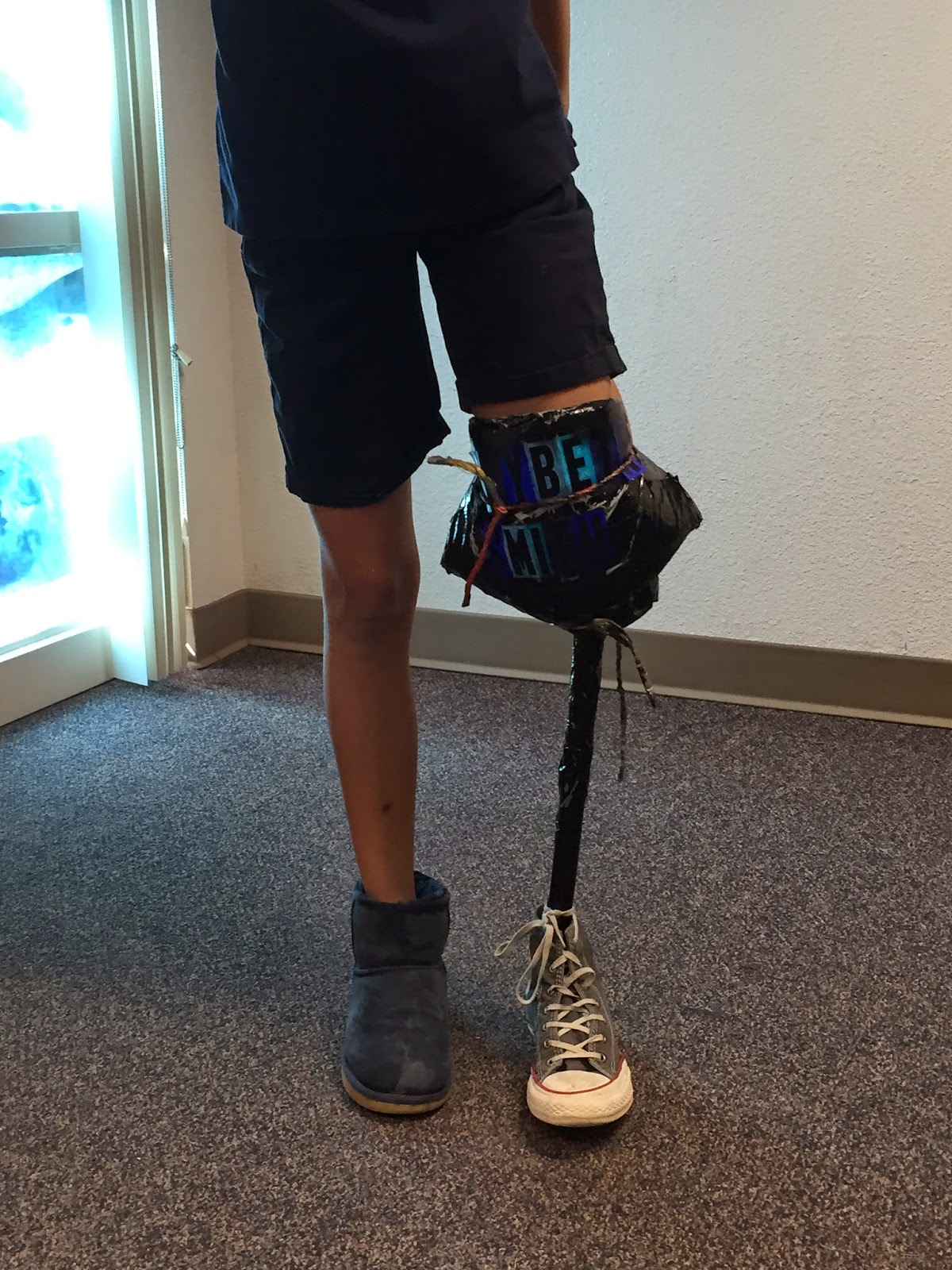 STEM: Building Prosthetic Limbs