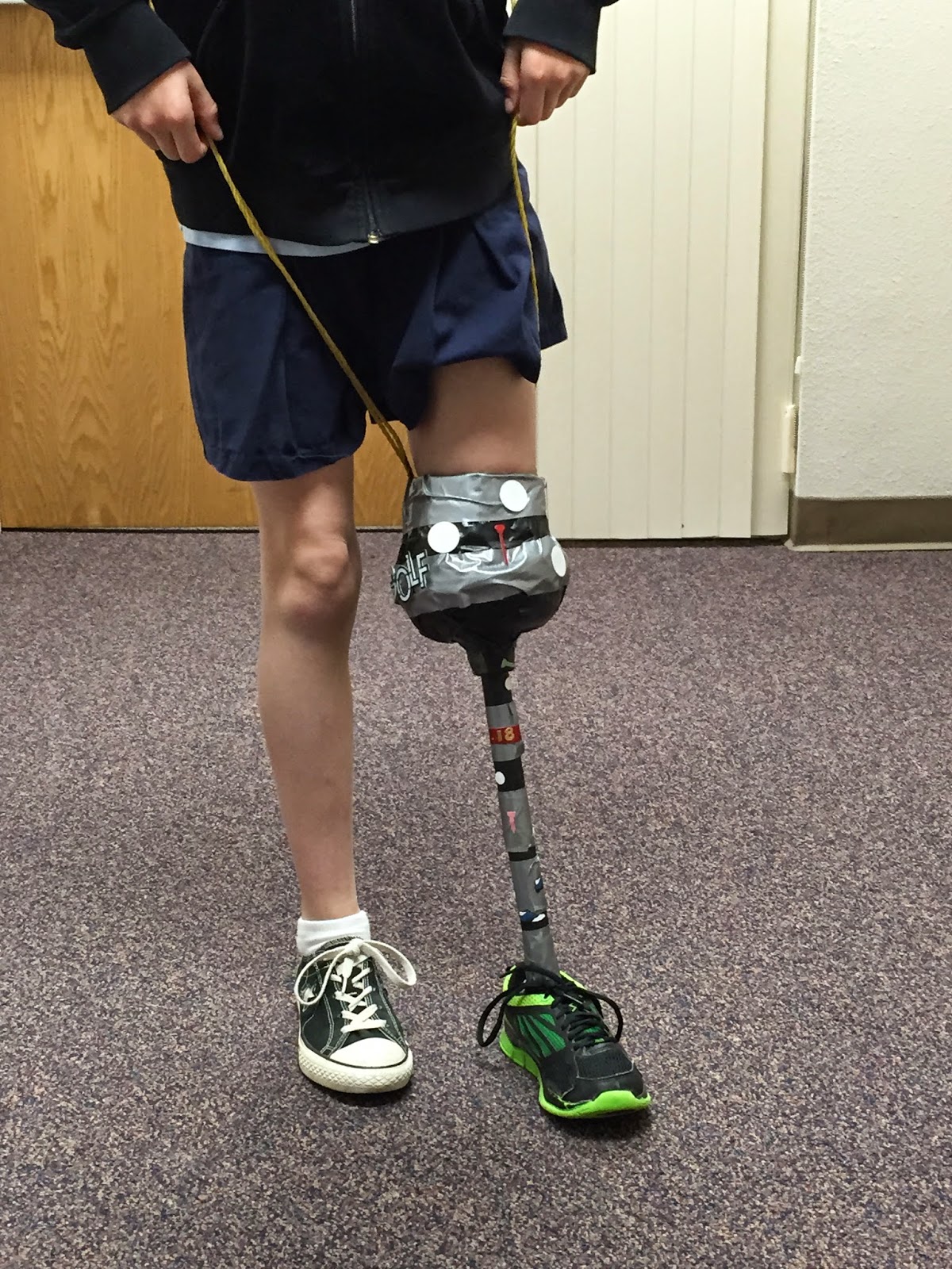 STEM: Building Prosthetic Limbs