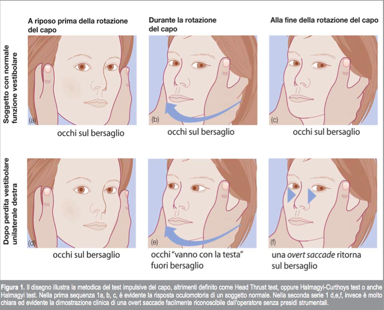Sito inerente le vertigini e disturbi dell'equilibrio: Il dott. Scarpa si occupa di patologie ...