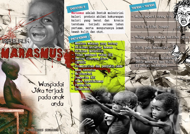 TEMBANG: Leaflet "Marasmus"