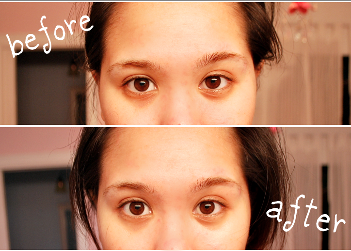 Download Dark Patch On Eyelid Free Orlandobittorrent download-dark-patch-on-eyelid-free-orlandobittorrent
