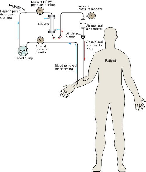 RENAL TECHNIK SERVICE HOW DOES A DIALYSIS MACHINE WORK renal-technik-service-how-does-a-dialysis-machine-work
