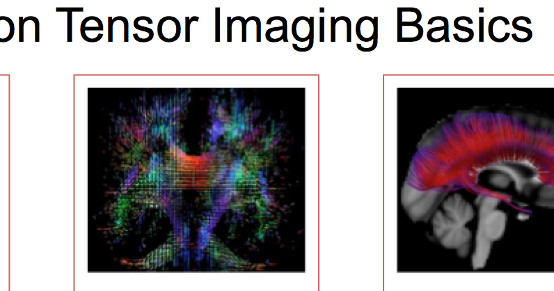 DTI Processing - The Basics | Diffusion Imaging; Introduction, tutorials and background on ...