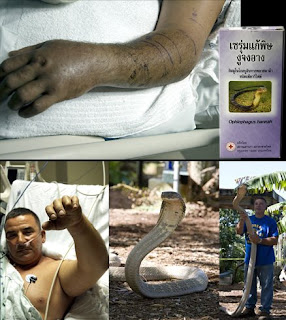 Ojatro's Blog: King Cobra Bite