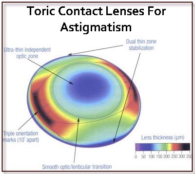 Pictures & Images: Toric Contact Lenses For Astigmatism