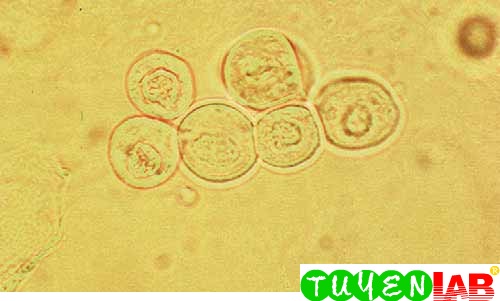 Atlas of cells in urine | Free Medical Atlas