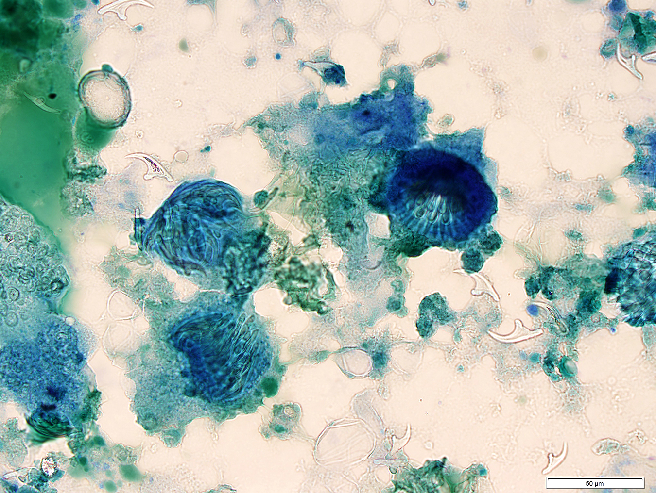 Creepy Dreadful Wonderful Parasites: June 2013