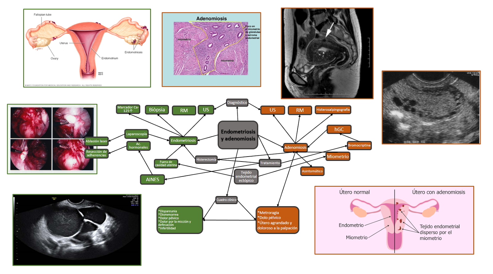 Blog de Ginecología y Obstetricia de Vladimir Solabdias Quiñonez Palacios Gpo. X-5