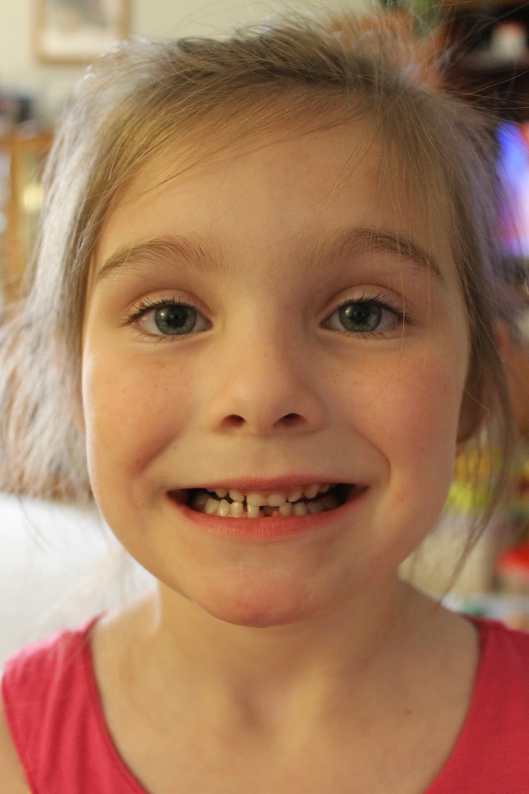 The Logan's: Lily's First Lost Tooth!