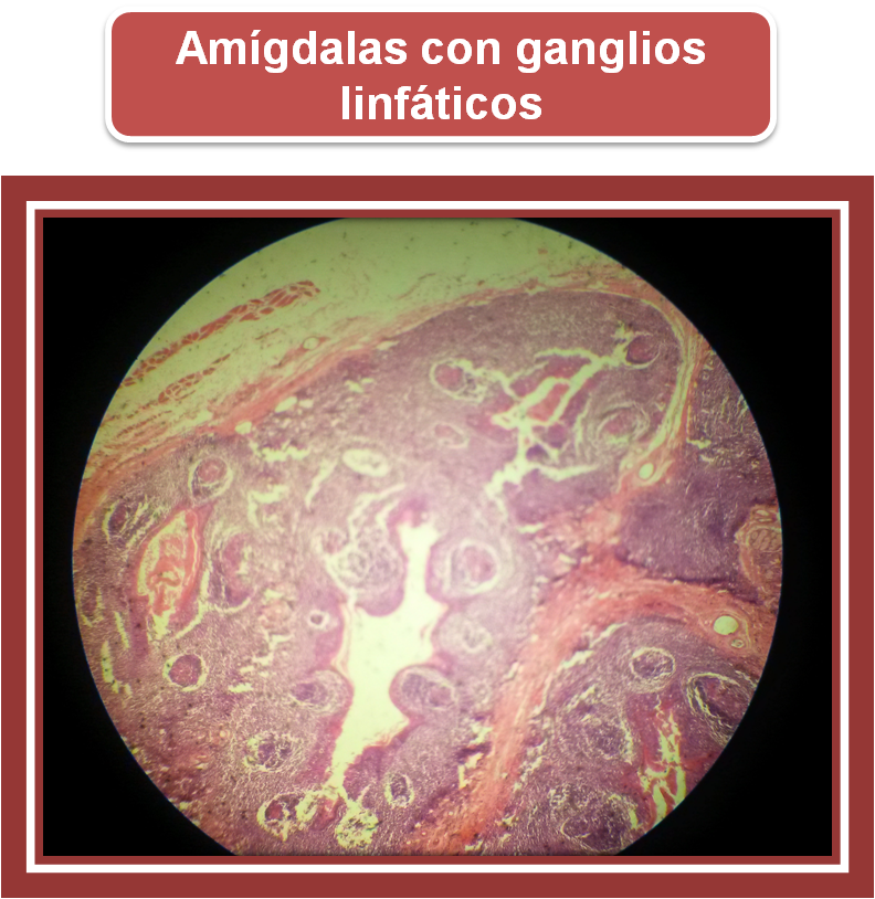 Album de Histologia : Tejido Linfoide