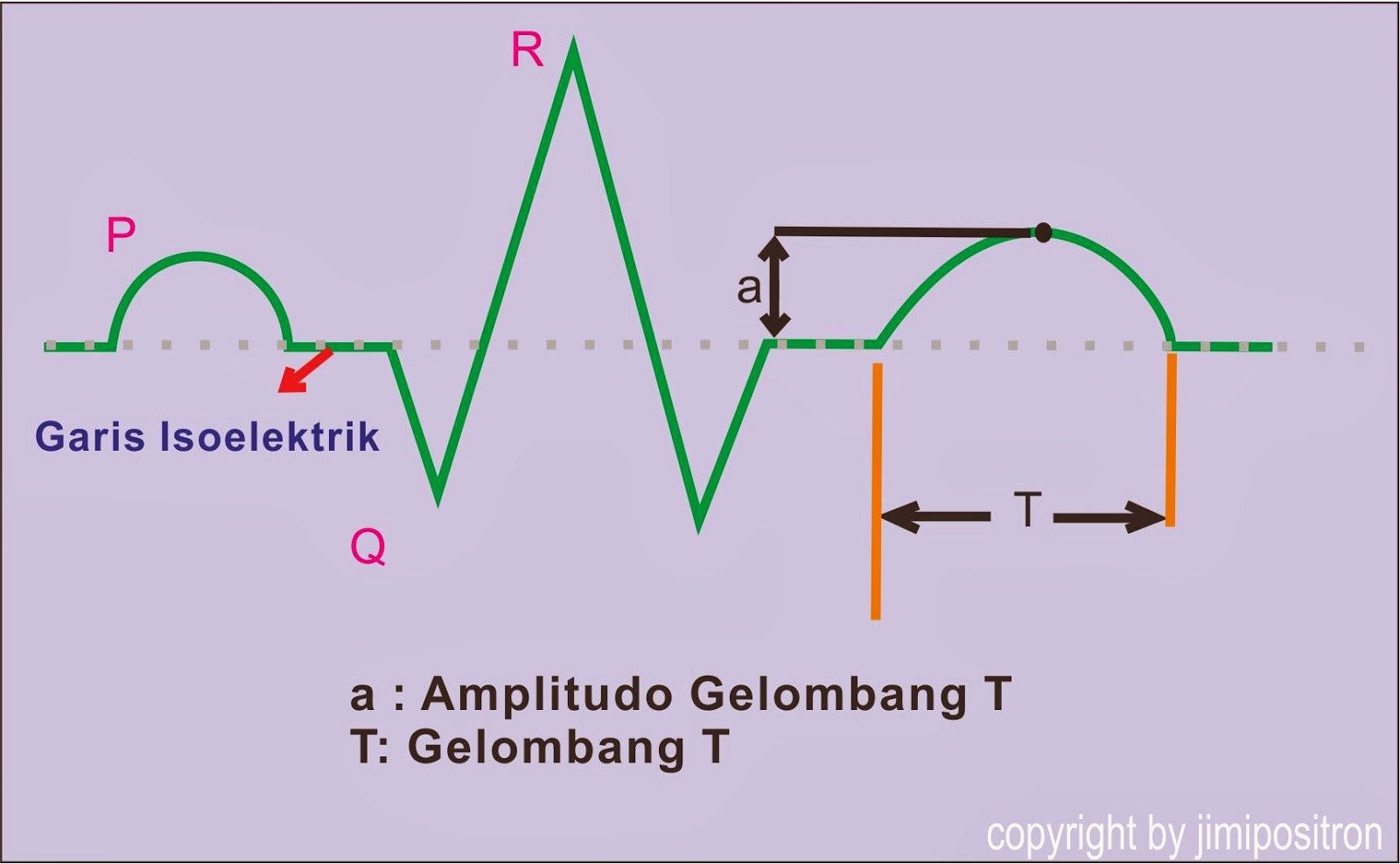Gelombang pada EKG