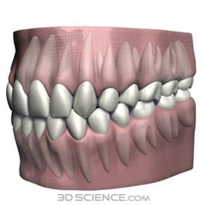 A.Fdez.Ollero: OCLUSIÓN DENTAL