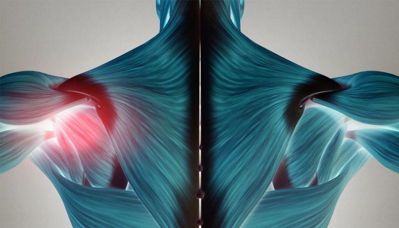 Blog Professor José Costa: Se você tiver muita dor muscular pós-treino ...