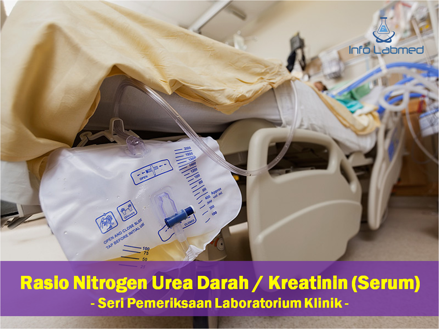 Rasio Nitrogen Urea Darah / Kreatinin (Serum) - Seri Edukasi Teknologi ...