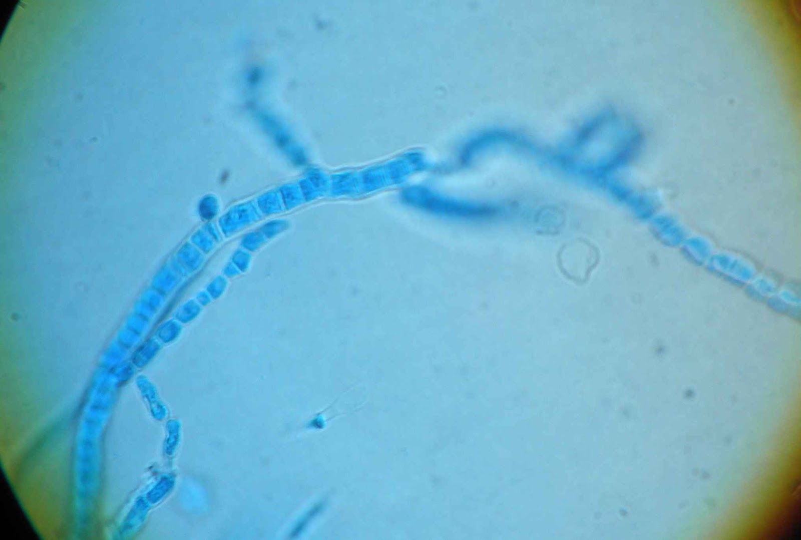 ATLAS MICOLOGIA: NEOSCYTALIDIUM HYALINUM