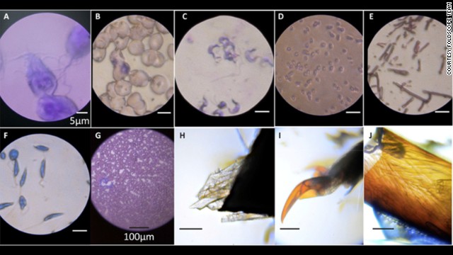VIDEO :Foldscope un microscopio de papel que cuesta menos de un dólar y ...