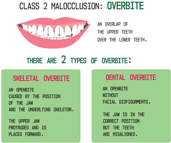 Dentist Best Dental Clinic in Vasundhara: What do you mean by ...