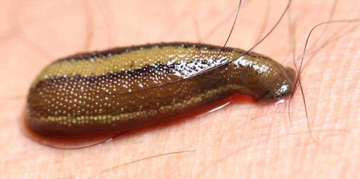 Terapi Lintah Yusuf Kencana: Khasiat Minyak Lintah