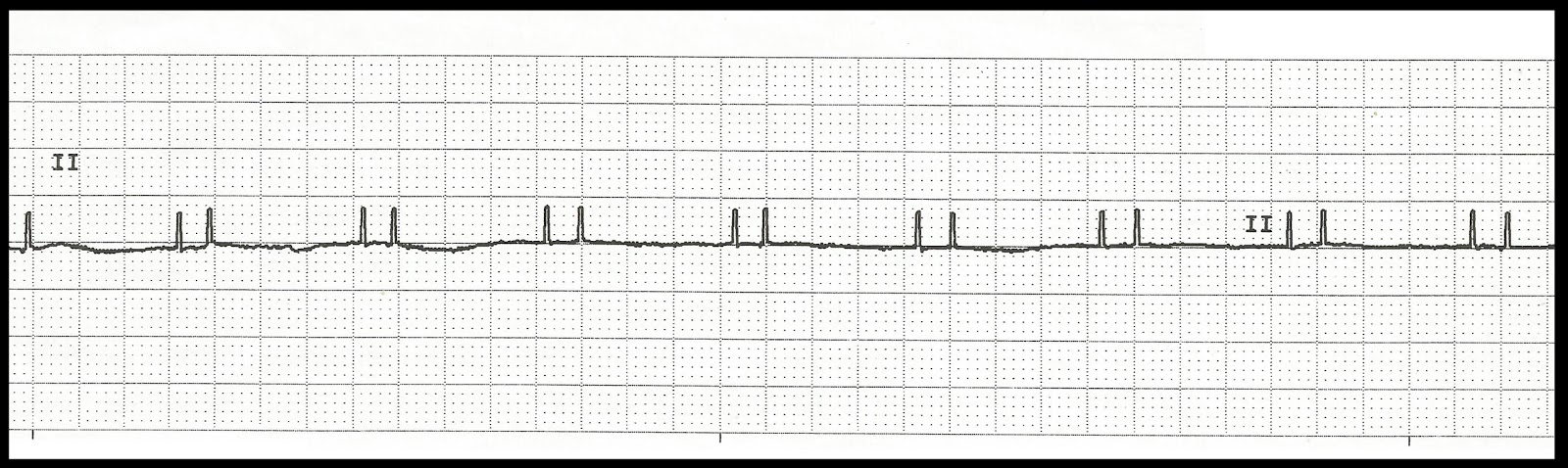 Float Nurse: Practice EKG Rhythm Strips 206