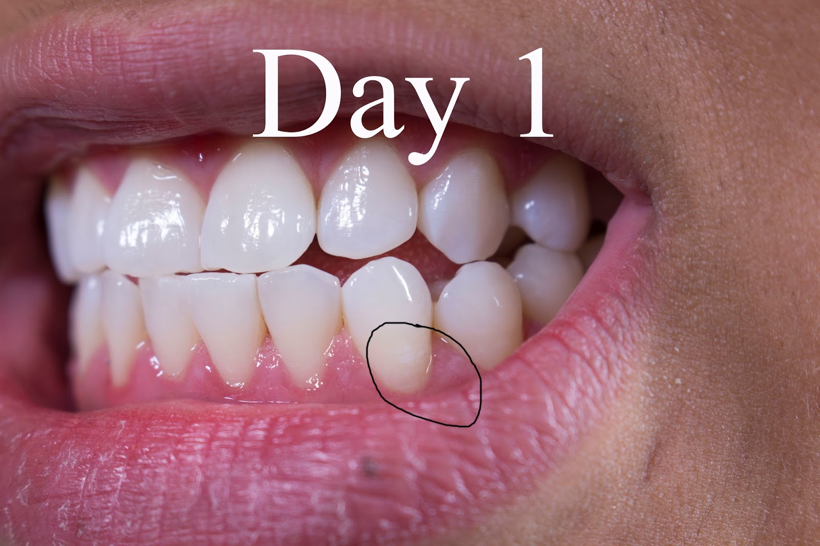 Simply Sovann: At Home Teeth Whitening For Coffee Addict