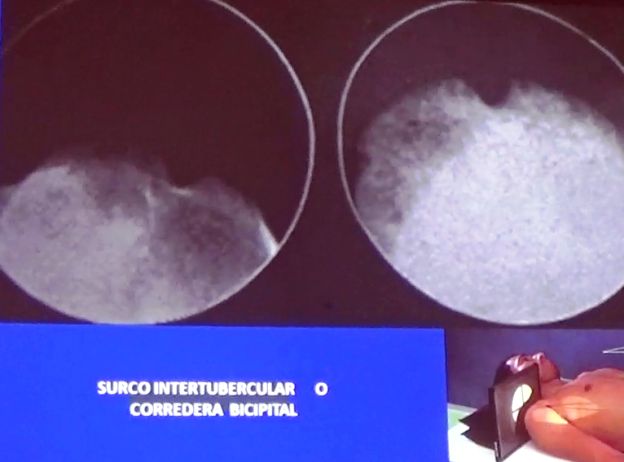 RADIOANATOMIA: CUARTA CLASE DE RADIOANATOMIA