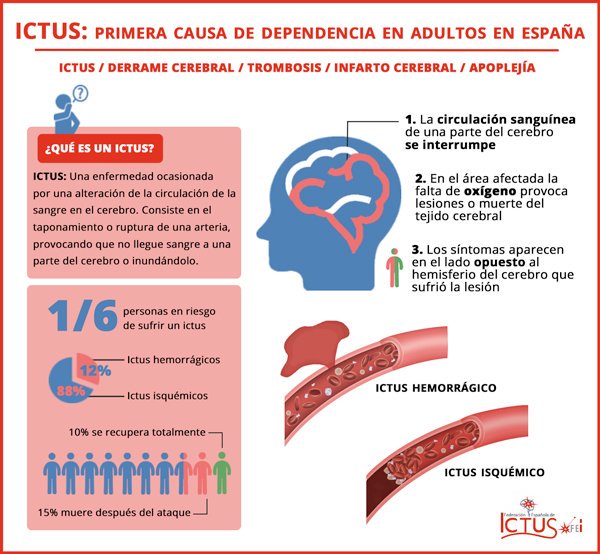 OFRASALUD: Qué es un ictus y cómo afecta a nuestra sociedad.