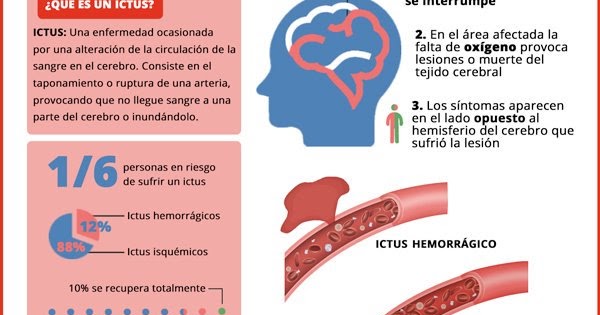 OFRASALUD: Qué es un ictus y cómo afecta a nuestra sociedad.