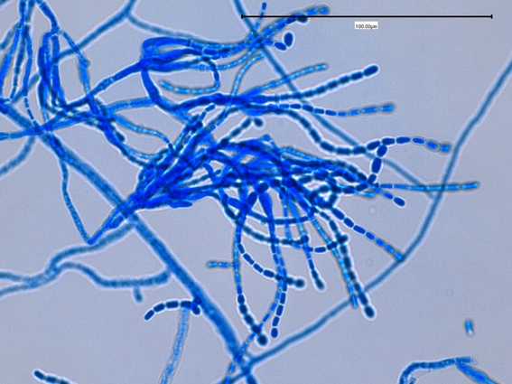 Fun With Microbiology (What's Buggin' You?): Arthrographis species