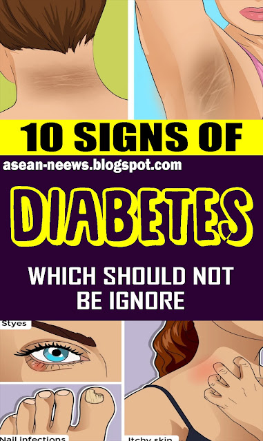 THE EARLY WARNING 10 SIGNS OF DIABETES, WHICH SHOULD NOT BE IGNORED ...