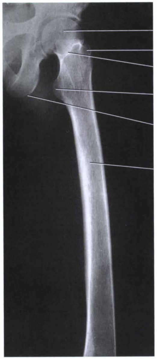 Gudang Medis: teknik radiografi femur