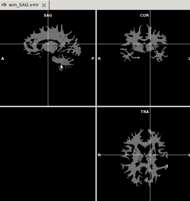 =Vision Group fMRI analysis guide=: Segmentation in Freesurfer, Rest in ...