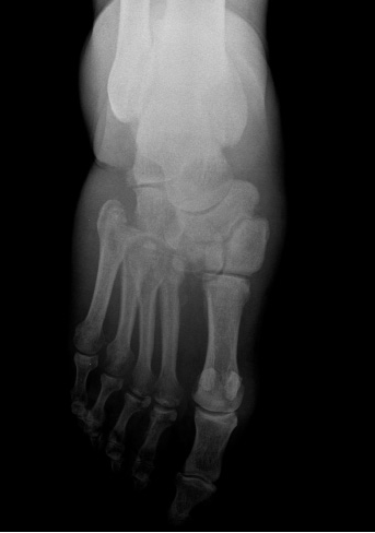 Tecnicos Radiologos: agosto 2015