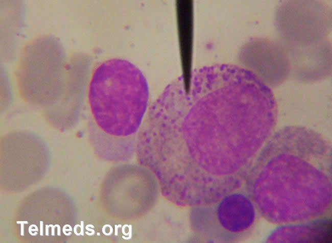 FICHERO DE HEMATOLOGIA: Leucopoyesis