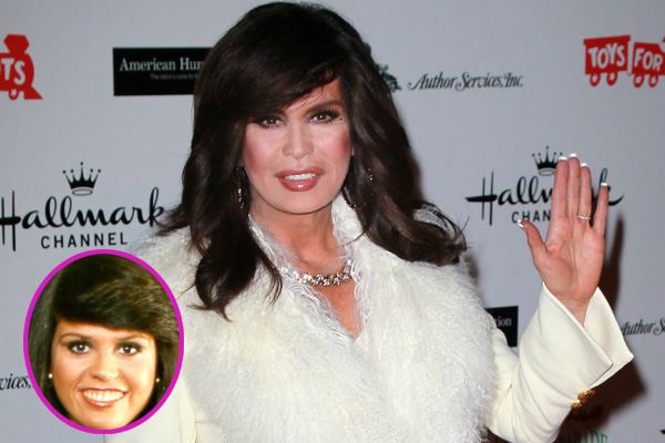 Free General Fashion: Marie Osmond Before And After Plastic Surgery ...