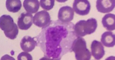 Valores Normales de Leucocitos: Agranulocitos: Monocitos y Plasmocitos ...
