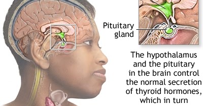 Hyperthyroidism- Causes, Symptoms & Treatments