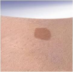 Study Medical Photos: Description Of Primary Skin Lesions