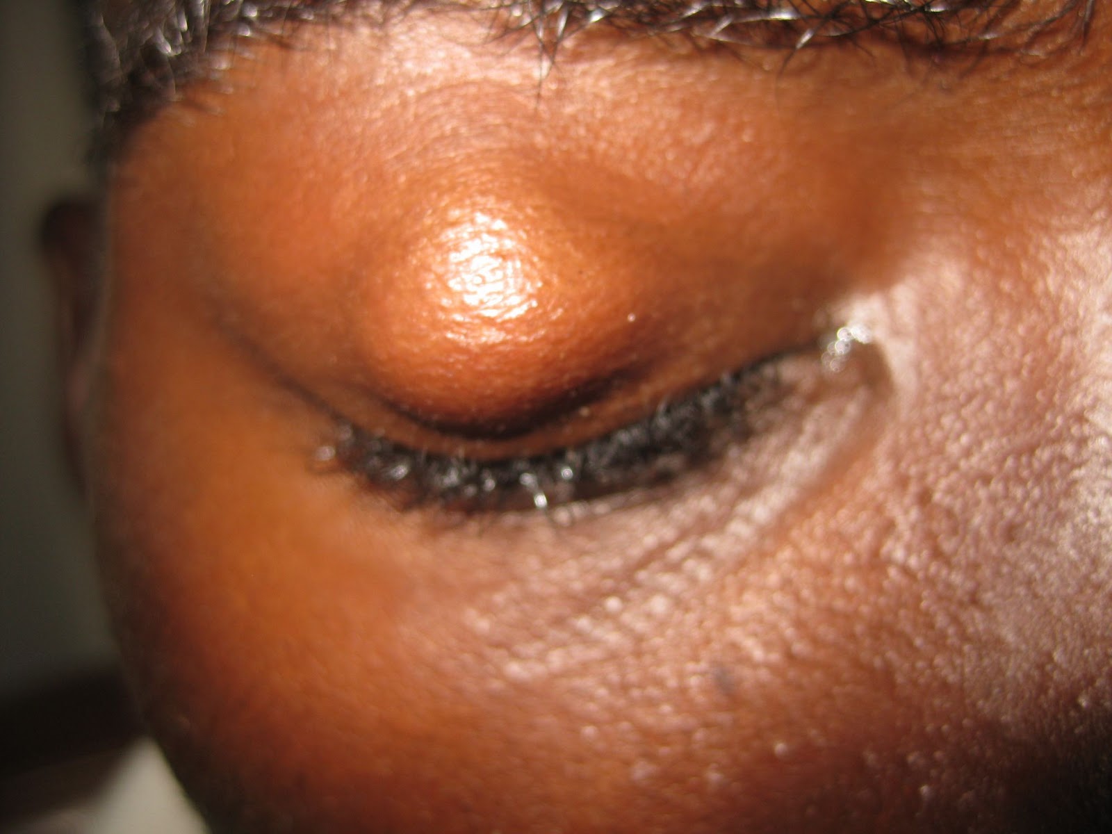 Yoos and Eyes in Zambia: This is Africa